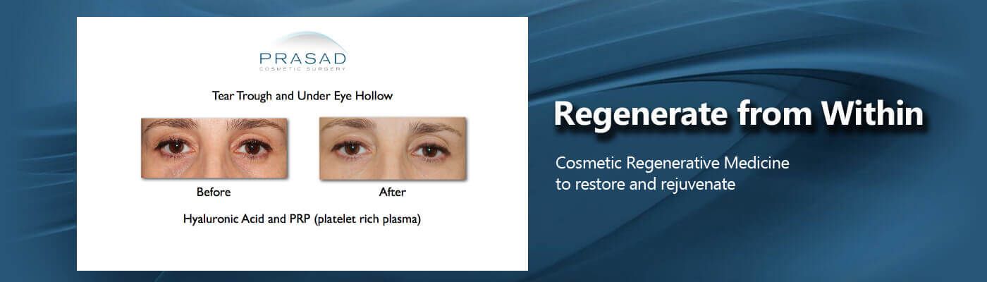 Dr. Amiya Prasad - Oculoplastic Surgeon | Blepharoplasty and Ptosis ...